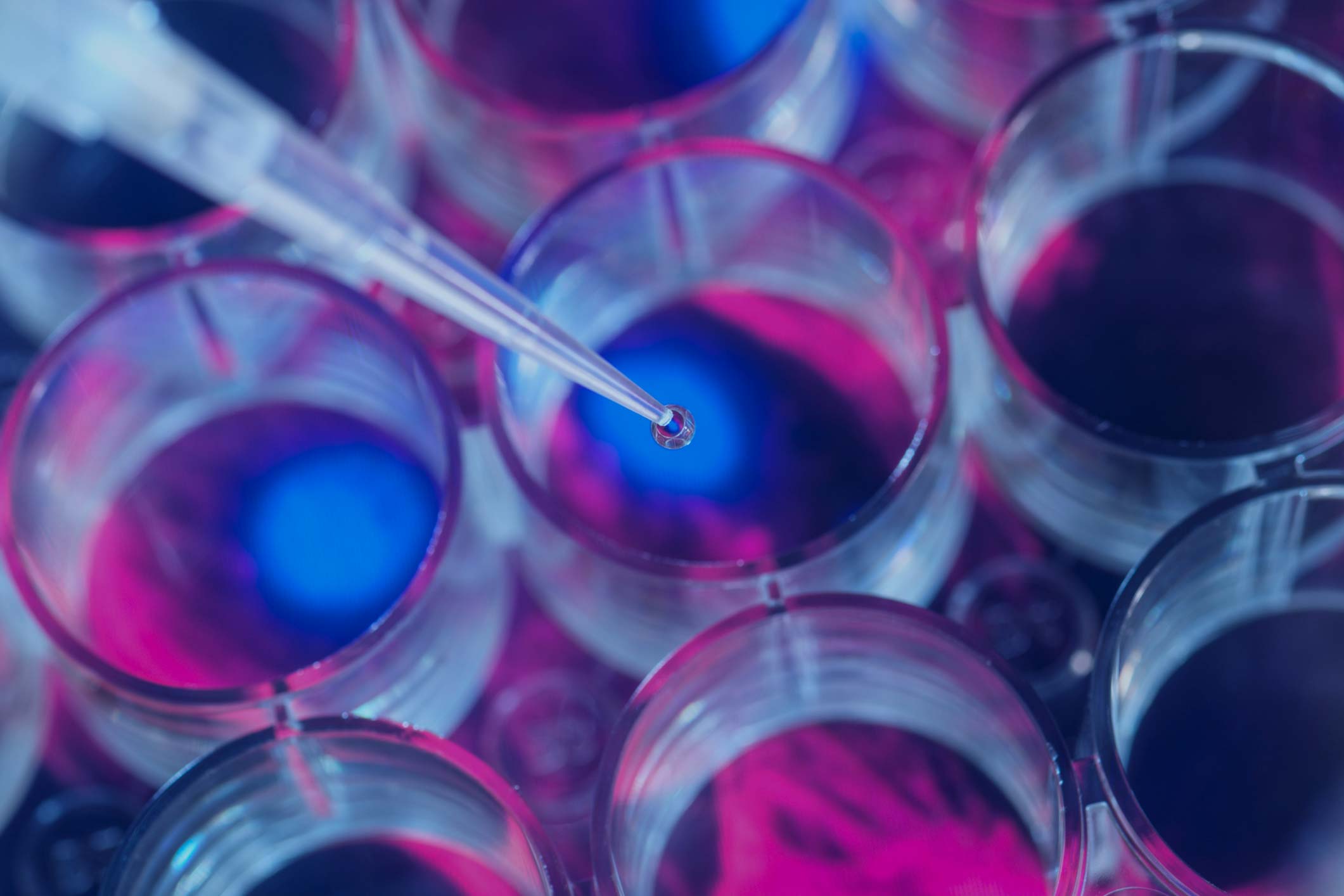 Pipeline - Rottapharm Biotech