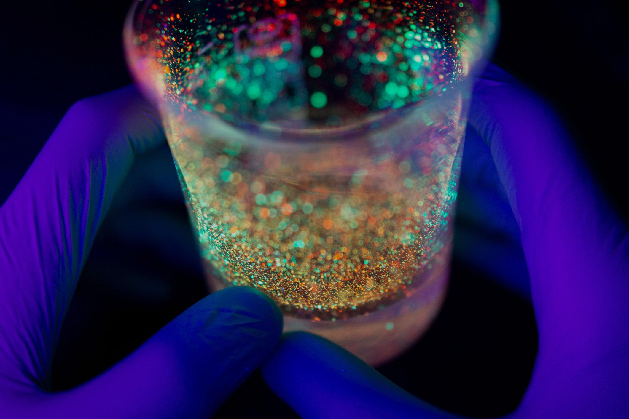 Genetic platform for osteoarthritis (OA) - Rottapharm Biotech